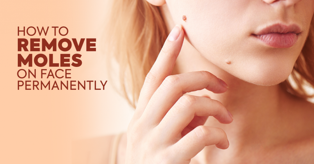 How To Remove Moles On Face Permanently: Visit Dermatologist