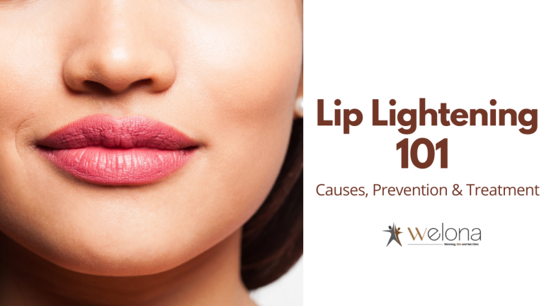 Lip Lightening - Cause, Prevention, and Laser Treatment - Welona