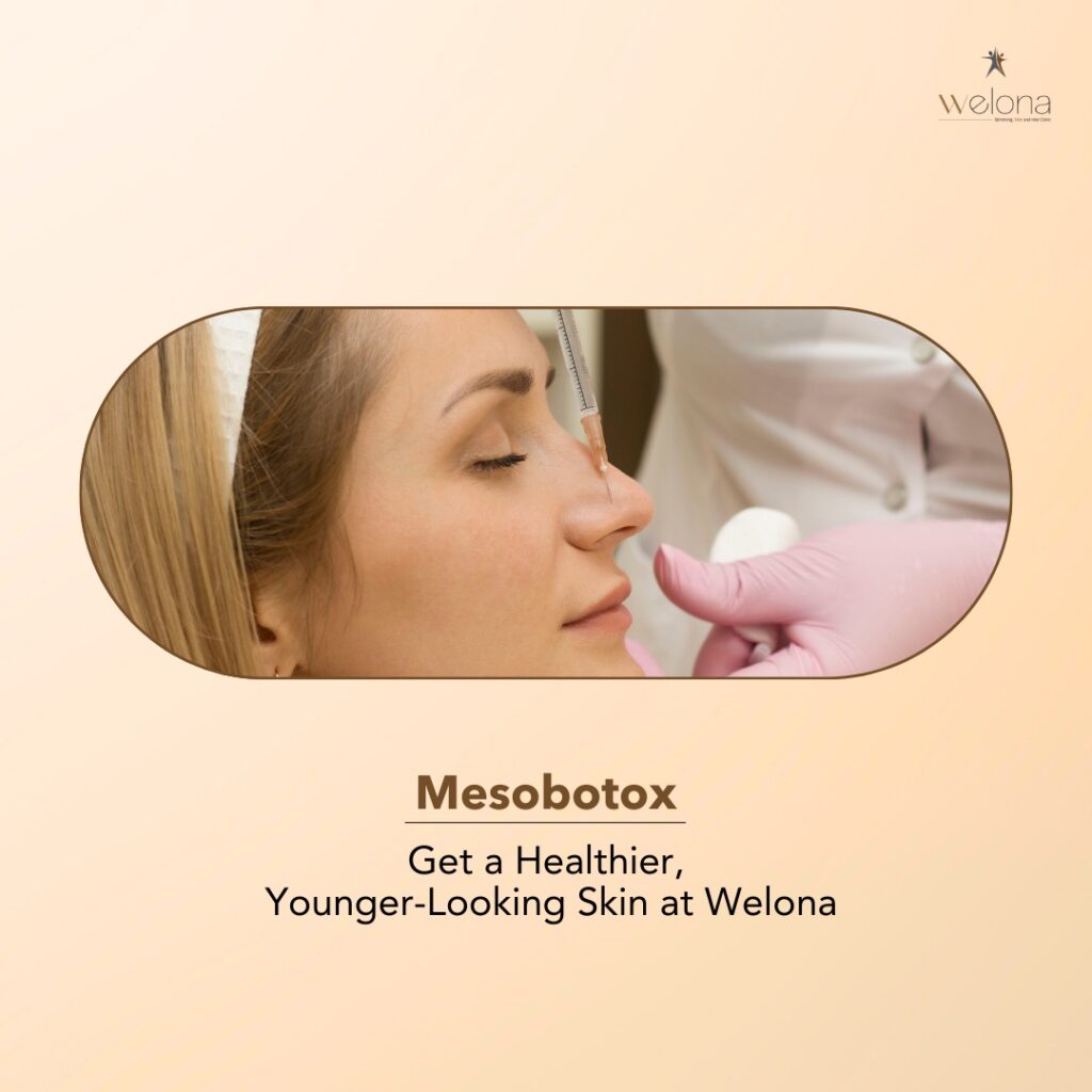 Mesobotox: Get a Healthier, Younger-Looking Skin at Welona - Welona
